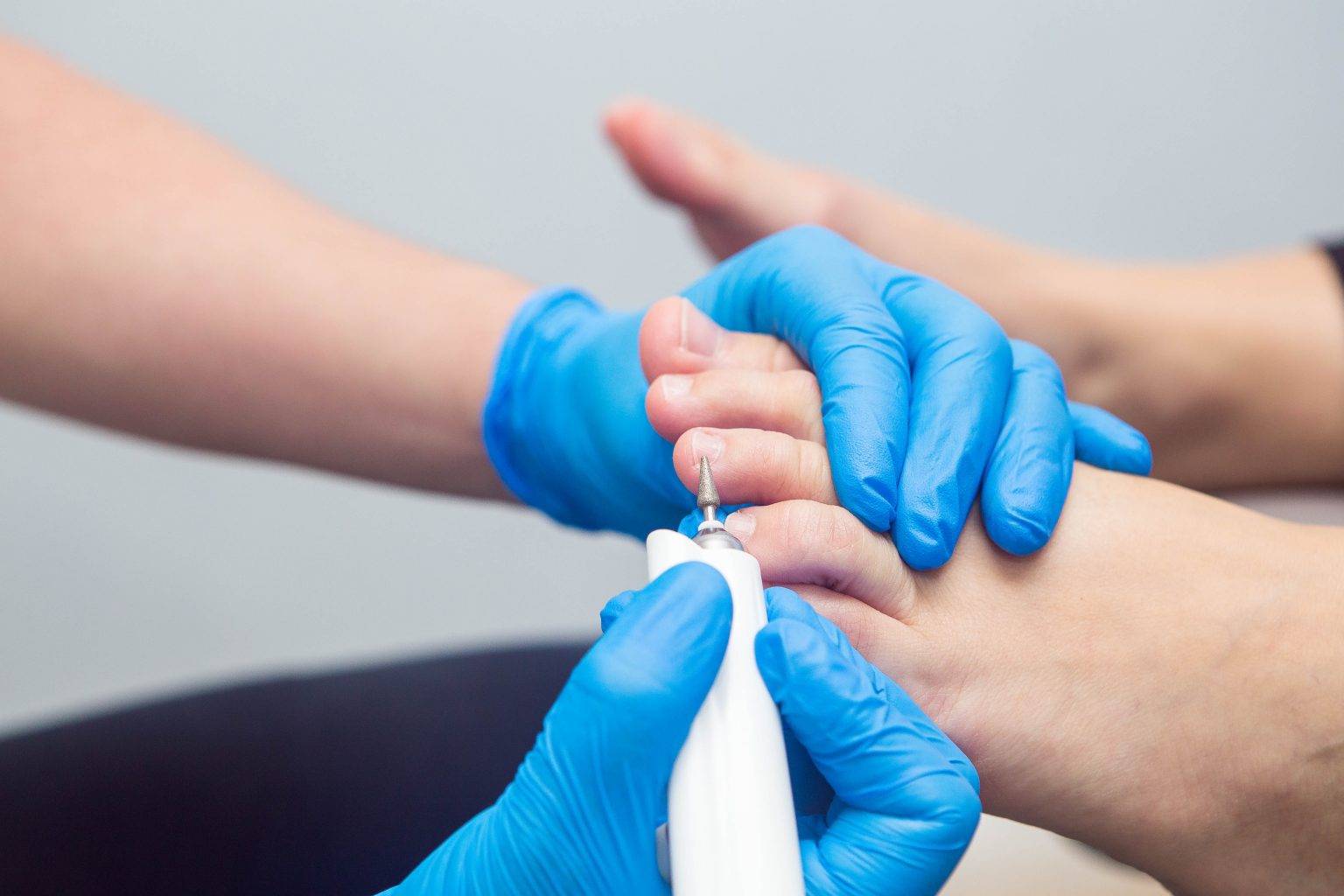 Absolute Footcare | Podiatry & Chiropody - North West & Wales